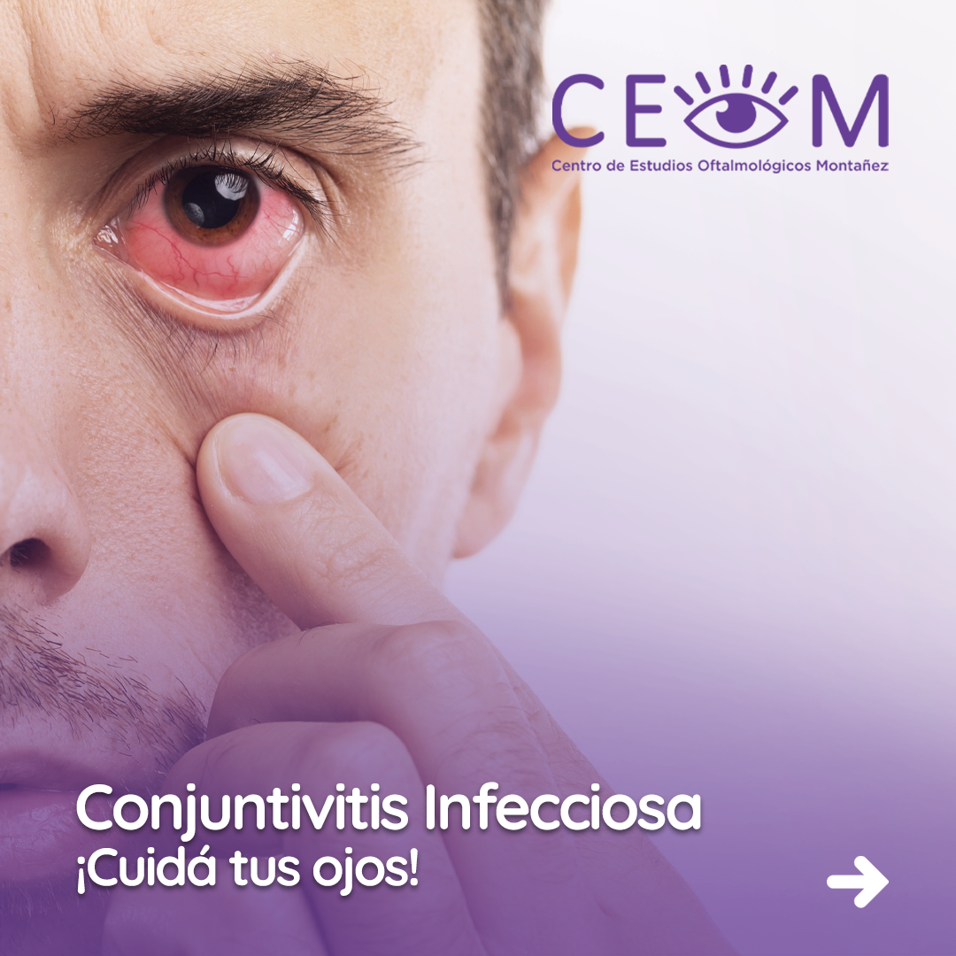 Conjuntivitis infecciosa – CEOM