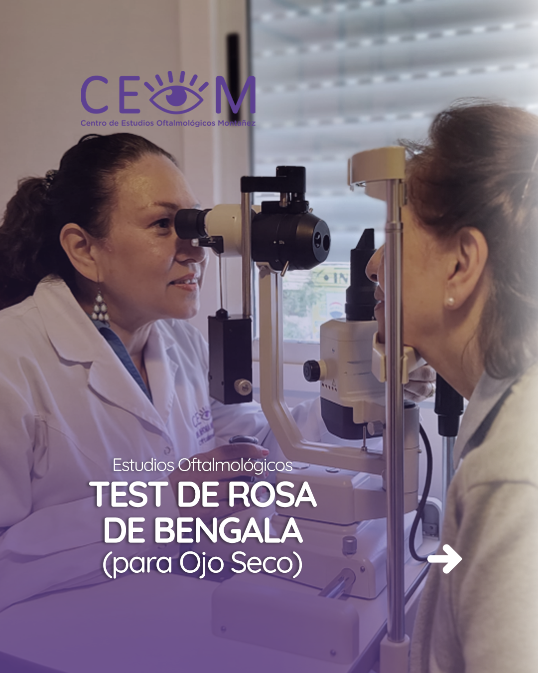 Estudios Oftalmológicos -Test de Rosa de Bengala (para Ojo Seco) – CEOM