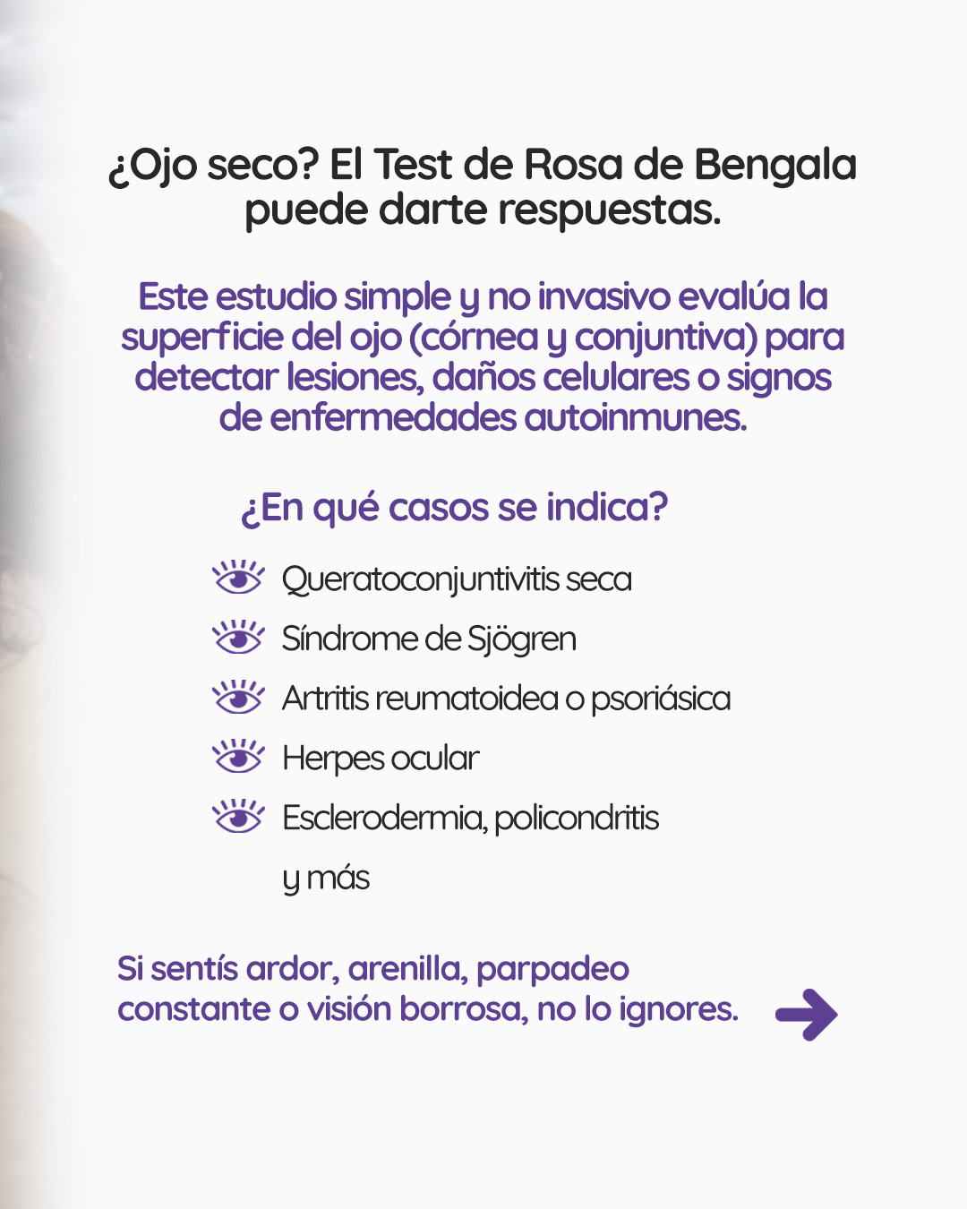 Estudios Oftalmológicos -Test de Rosa de Bengala (para Ojo Seco) – CEOM